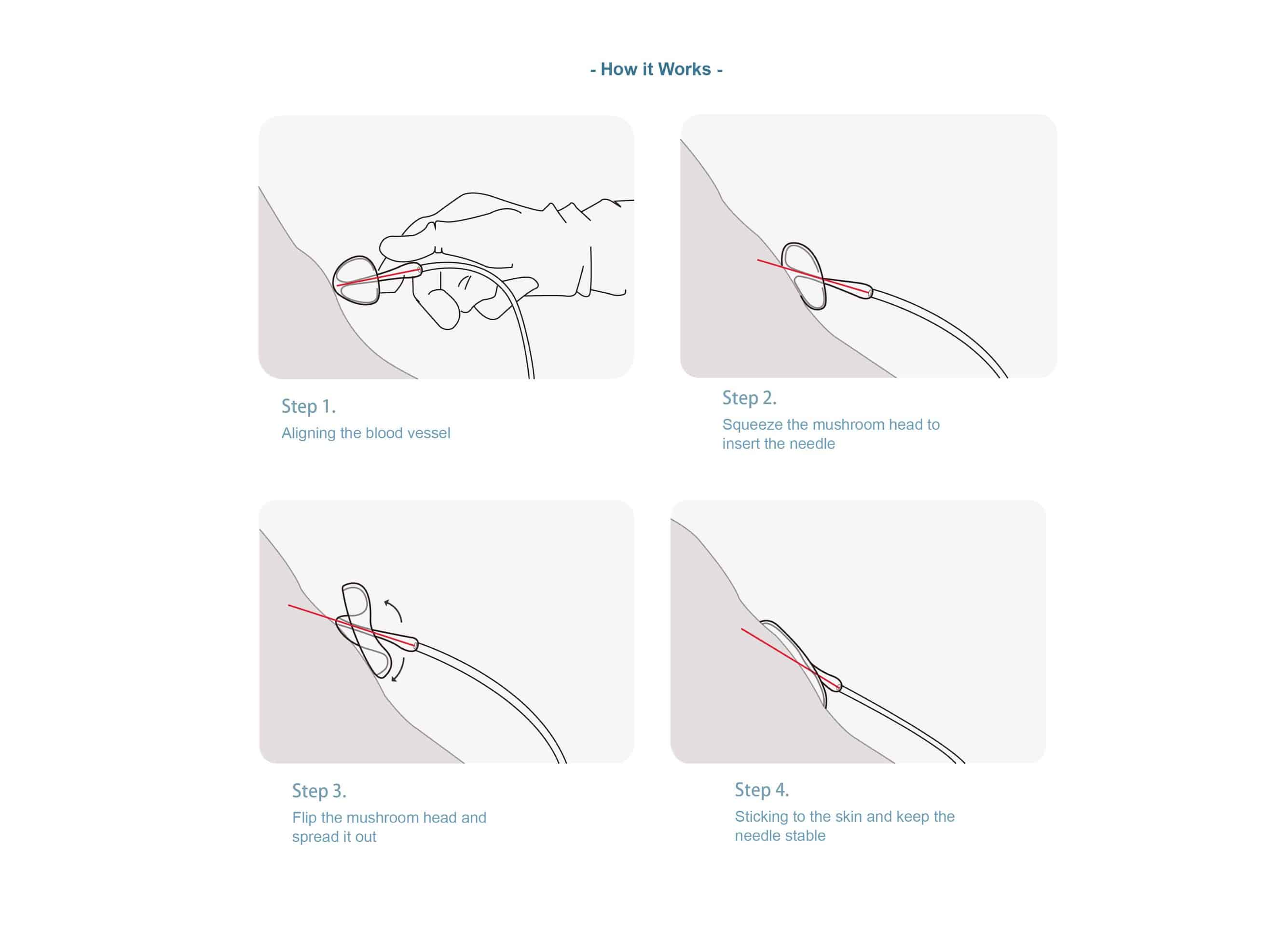 Mushroom Needlecover | Design Ideas